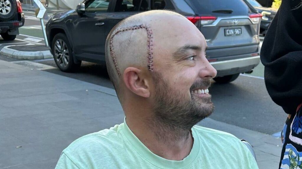 Howlong Man Fights Terminal Cancer with Determination and Hope