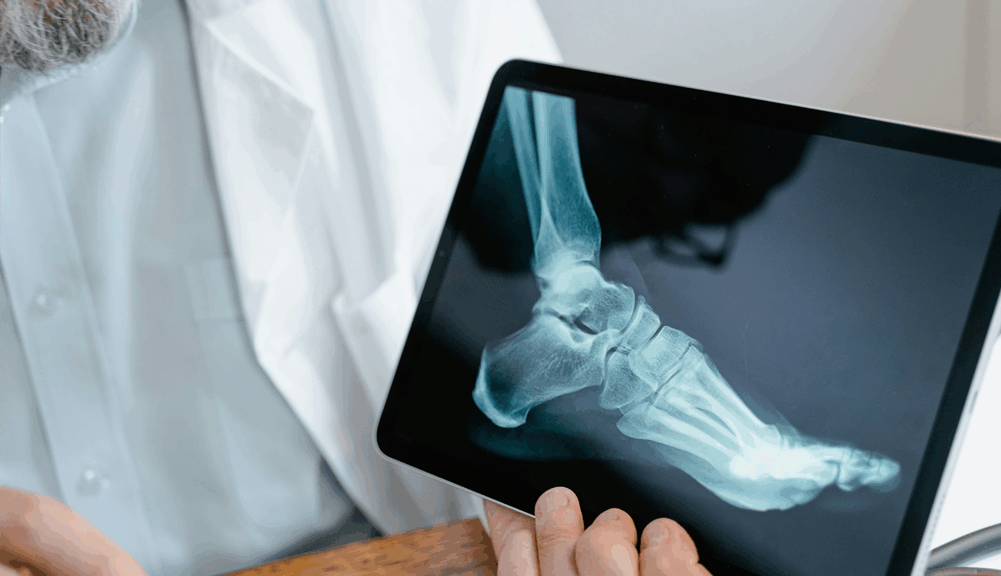 Understanding Calcium Levels: What They Reveal About Bone Health