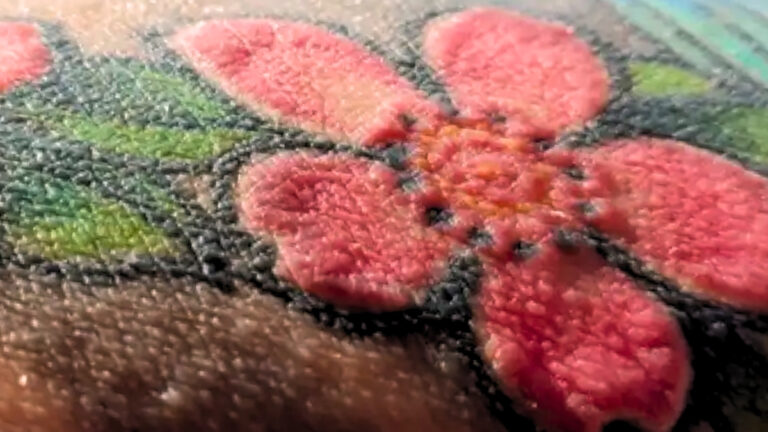 Polish Man's Tattoo Sparks Severe Health Crisis, Highlights Risks